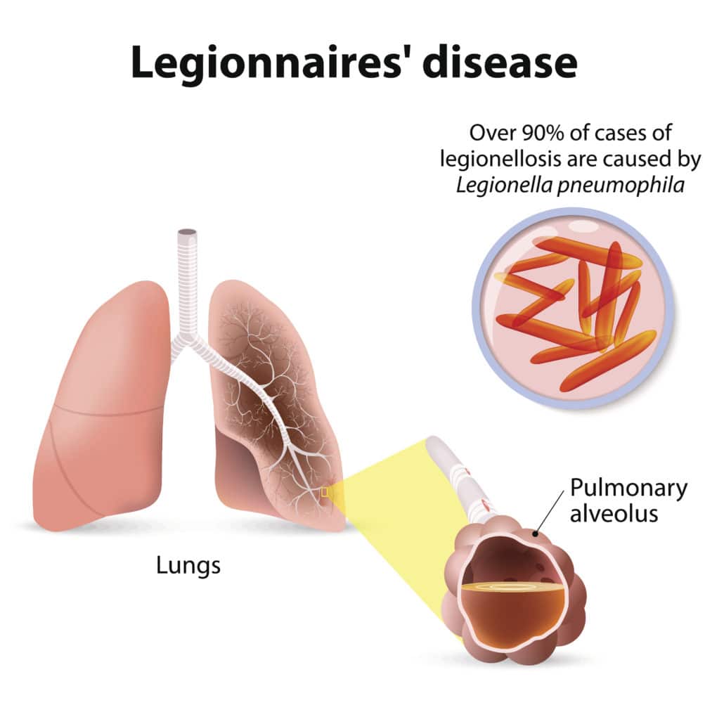 HVAC Systems and Legionnaires' Disease